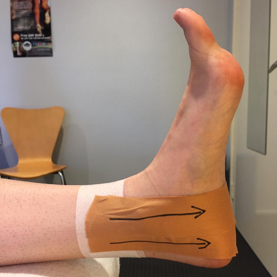 How to strap an ankle - Inspired Physiotherapy